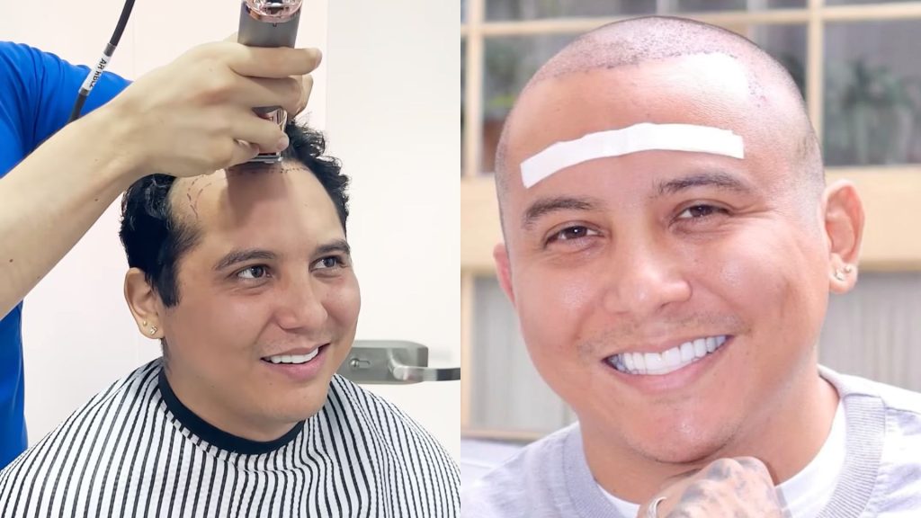 Edwin Luna se defiende de las críticas por sus arreglos estéticos – La ...